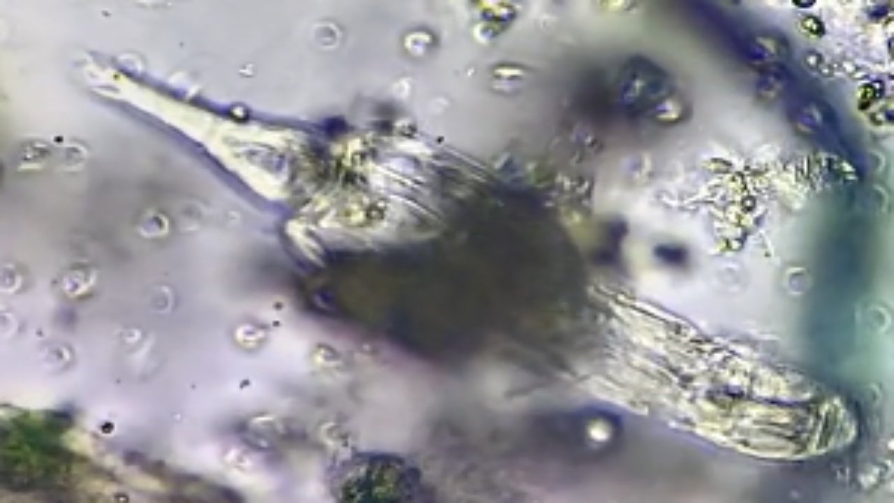 Cosa si nasconde nella tua lavatrice: non immaginerai | Video