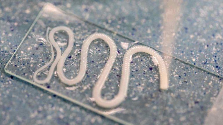 Verme solitario: i sintomi con i quali contattare un medico